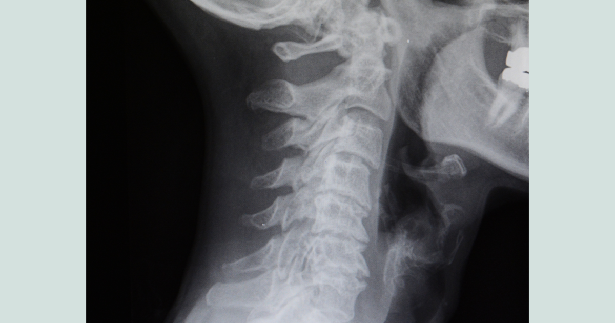 Fashion’s Spineless Season: Brands Retreat From ESG and DEI as Extremism Rises - Good On You